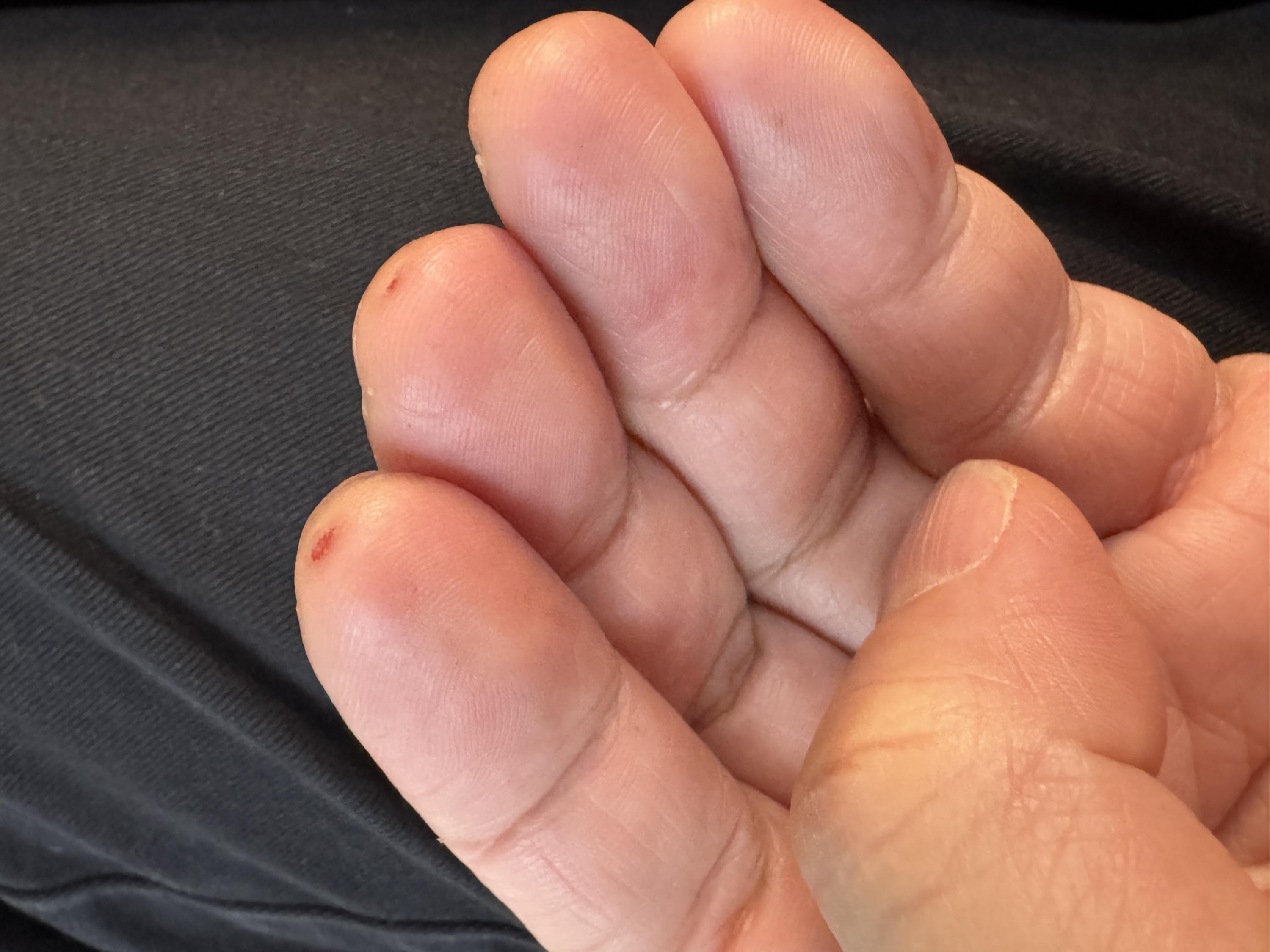 Dealing with paper cuts on fingertips of fretting hand?
